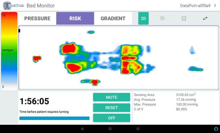 Bed Monitoring System - From BodiTrak