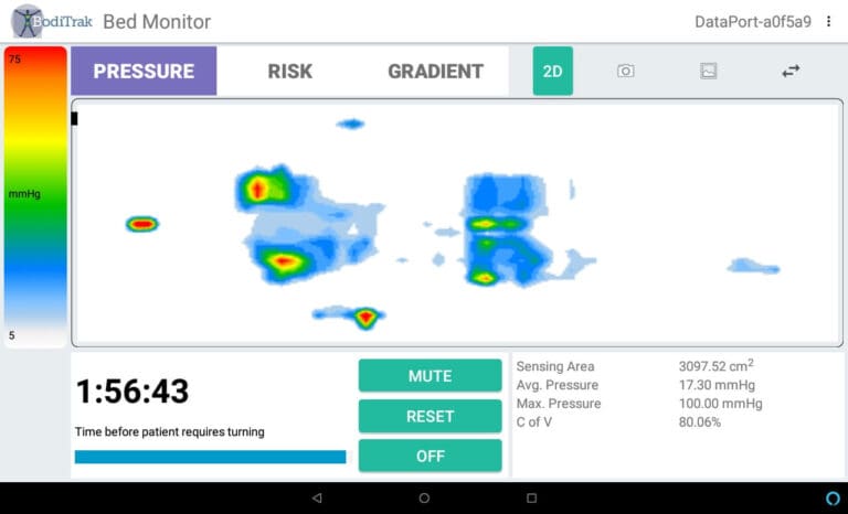 Bed Monitoring System - From BodiTrak