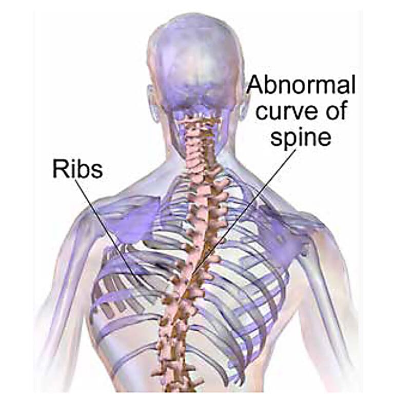 Trunk Call - Aligning the Upper Body - Healthcare Innovations Australia - Shear Comfort range of ...